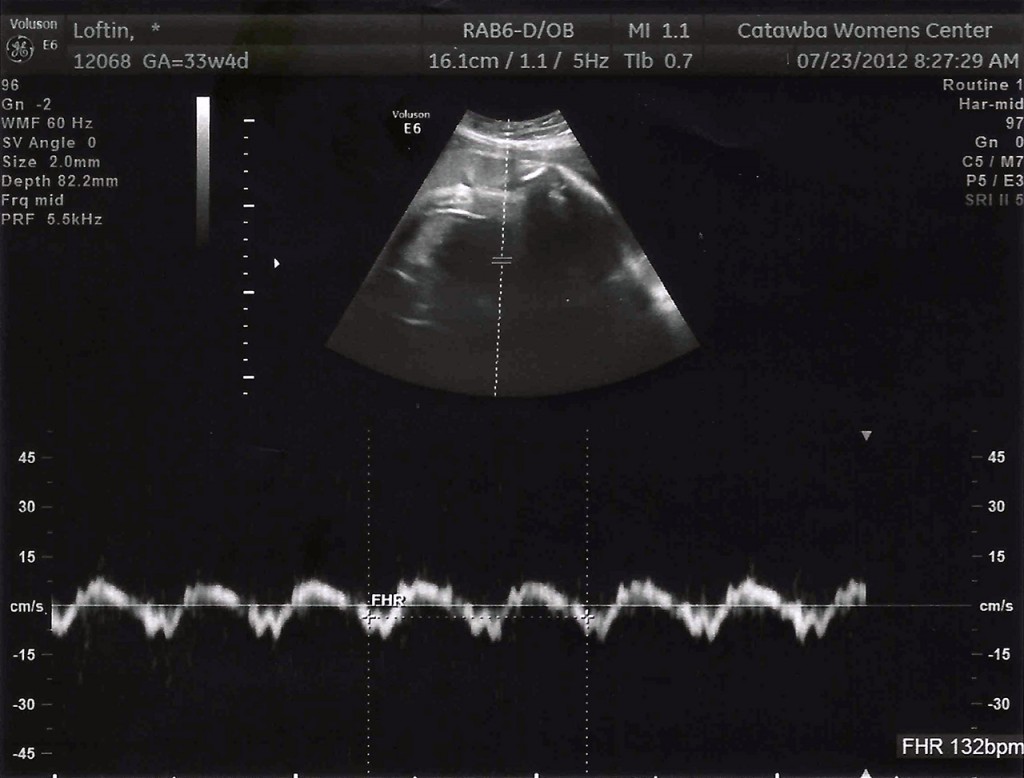 Ultrasound (34 weeks) – Philip, Leslie & Kayli